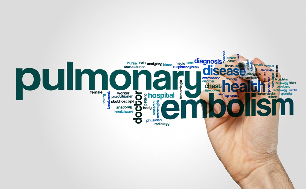Pulmonary Embolism: For Some Clots, It Takes a Village - Massachusetts ...