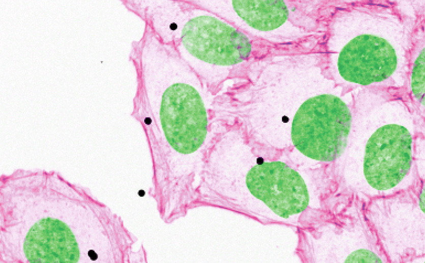 MGH Research Scholar Creates Tiny Lasers for Cells--MGH Giving